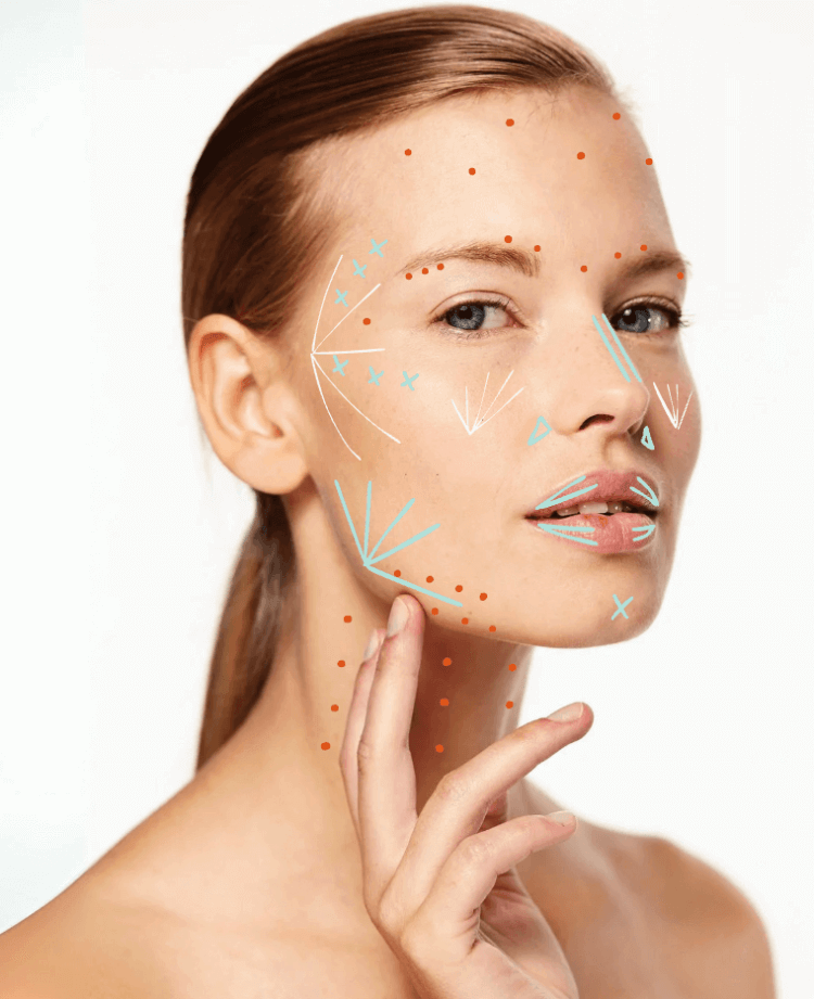 Harmonisation faciale : visage sculpté – Dr Tordjmann Leslie